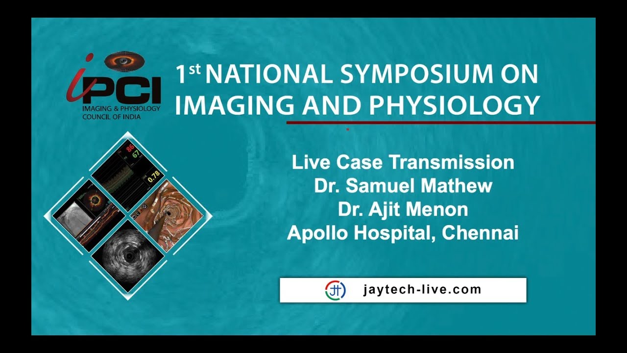 IPCI 2018 - Live Case TX - Dr. Samuel Mathew & Dr. Ajit Menon, Apollo ...
