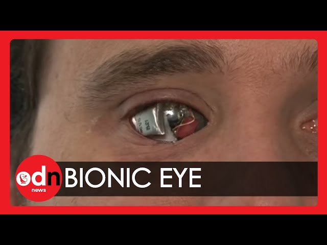 Cyborg Eyeball Cyborg Eye: Over 11,772 Royalty Free Licensable Stock
