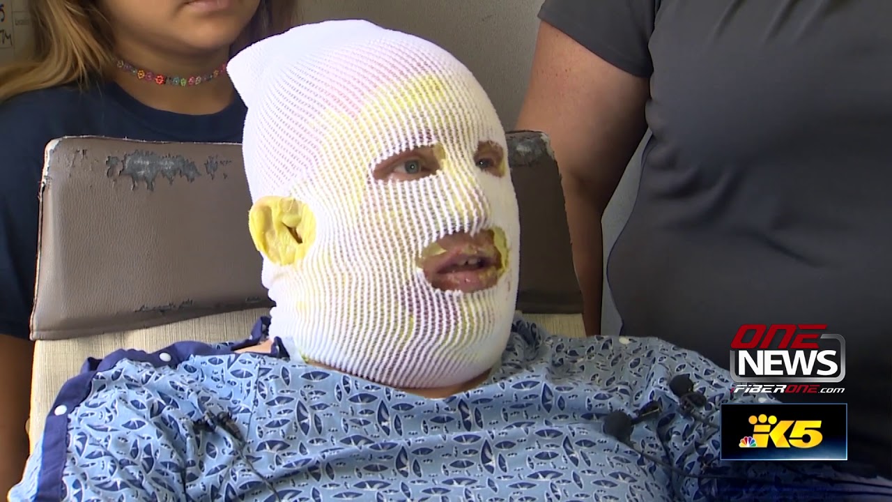 Firefighter burned in Grass Valley Fire speaks out from hospital room ...