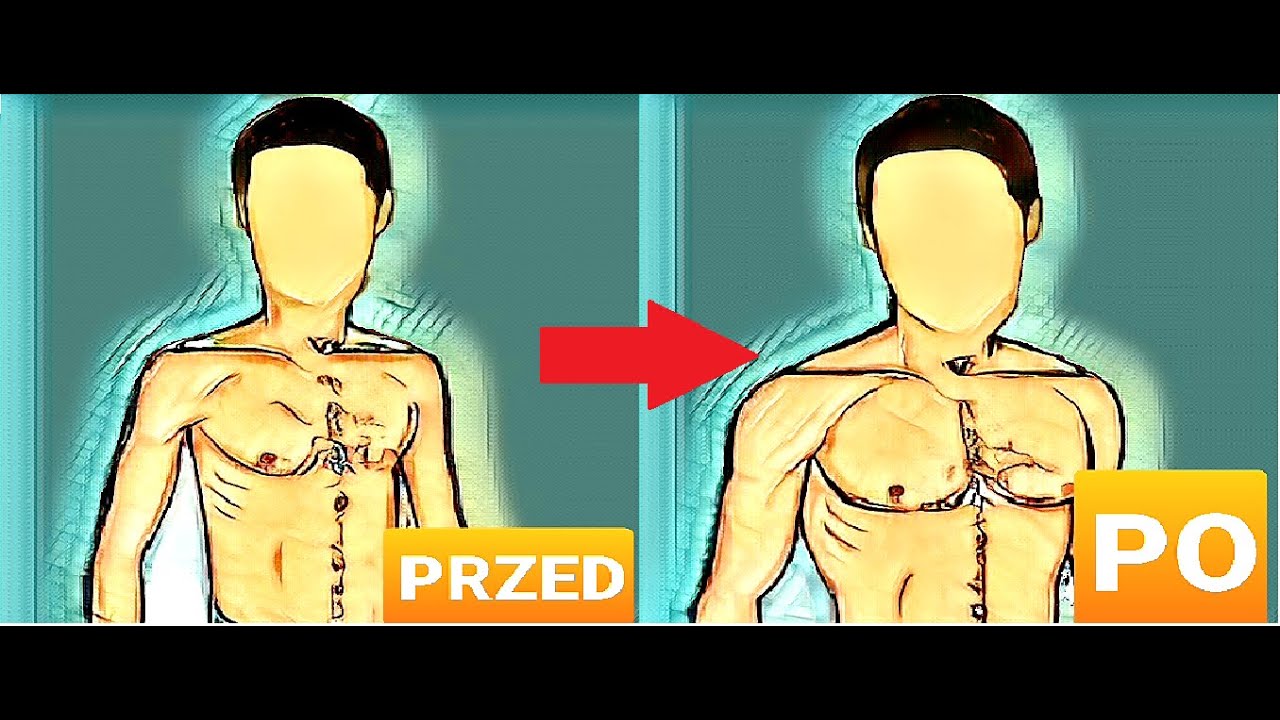 5 sposobów na przybranie wagi dla szczupłych osób - YouTube