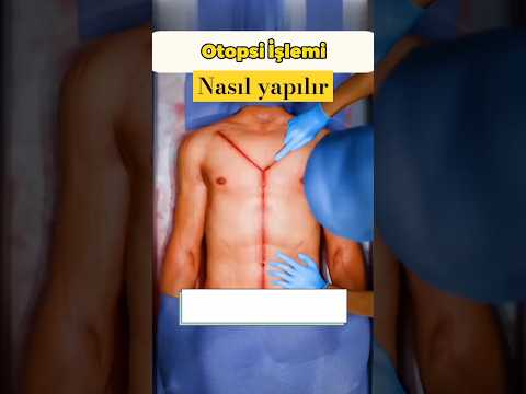 Otopsi Nasıl Yapılır? #keşfet #keşfetteyiz #shortvideo #shortsvideo #shortsviral
