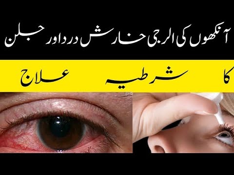 انکھوں کے مسائل اور ان کا گھریلو علاج eye diseases #eyesdes #eyes # ...