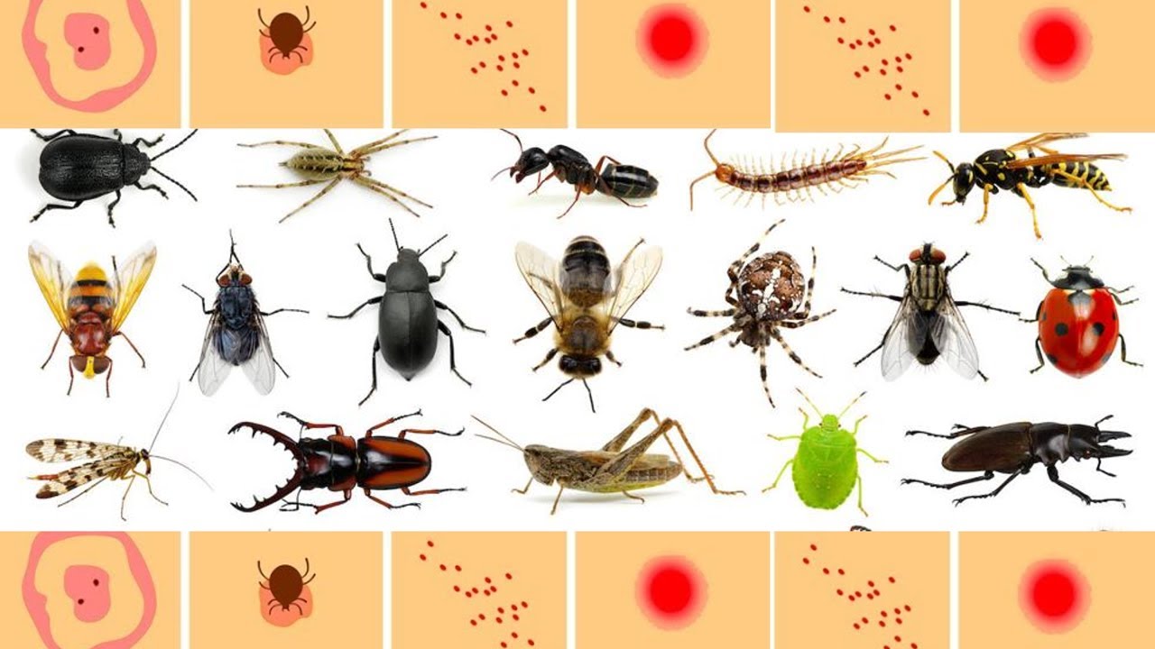 Cómo identificar una picadura de insecto y qué hacer con ella | Te Picó ...