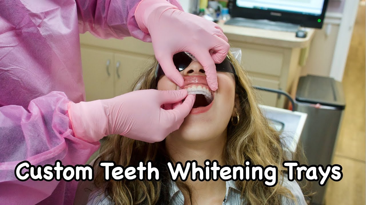 Brianna Custom Teeth Whitening Trays in 1080p - YouTube