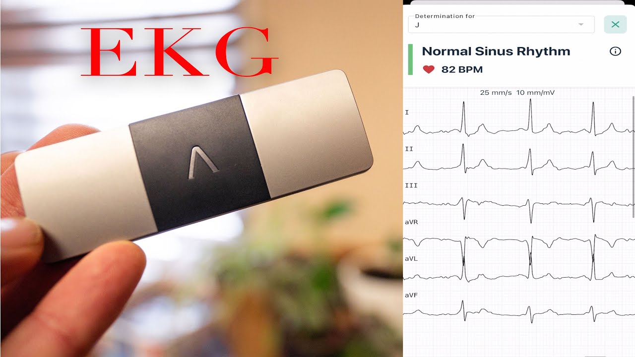 EKG at Home - KardiaMobile 6-Lead Personal EKG Monitor - YouTube