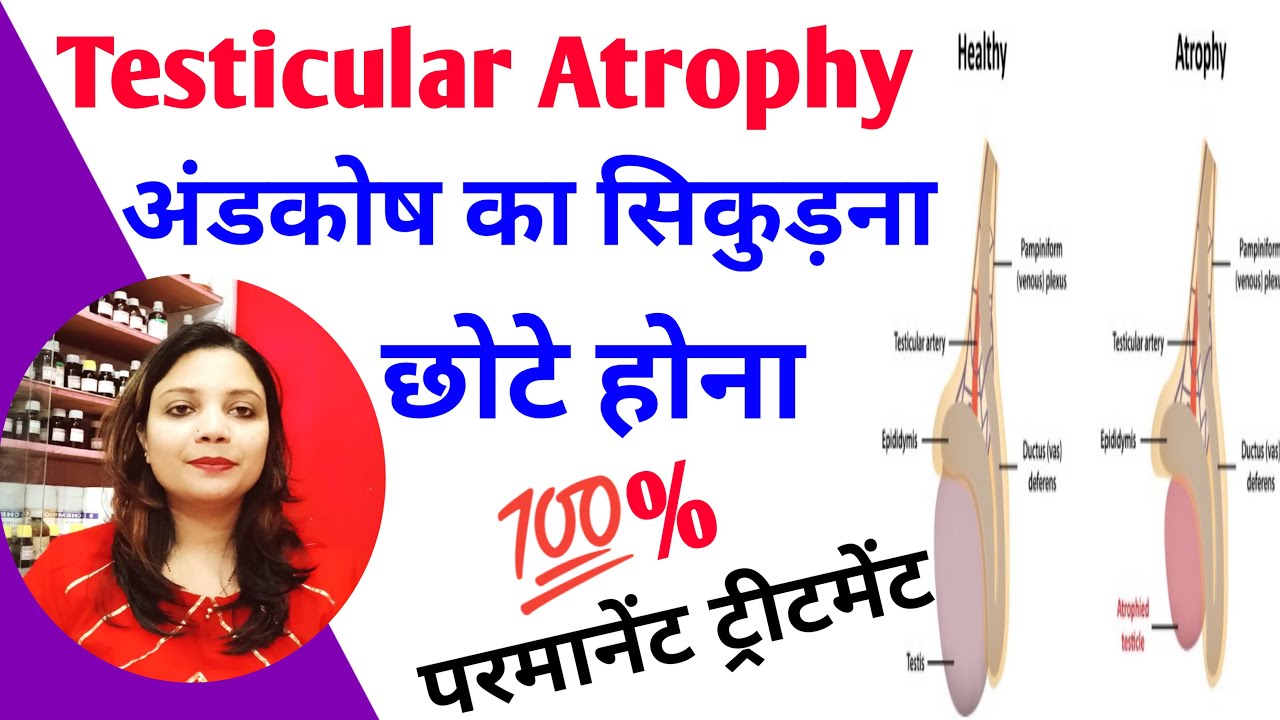 Testicular Atrophy | causes, symptoms | अंडकोषों का सिकुड़ना या छोटा ...