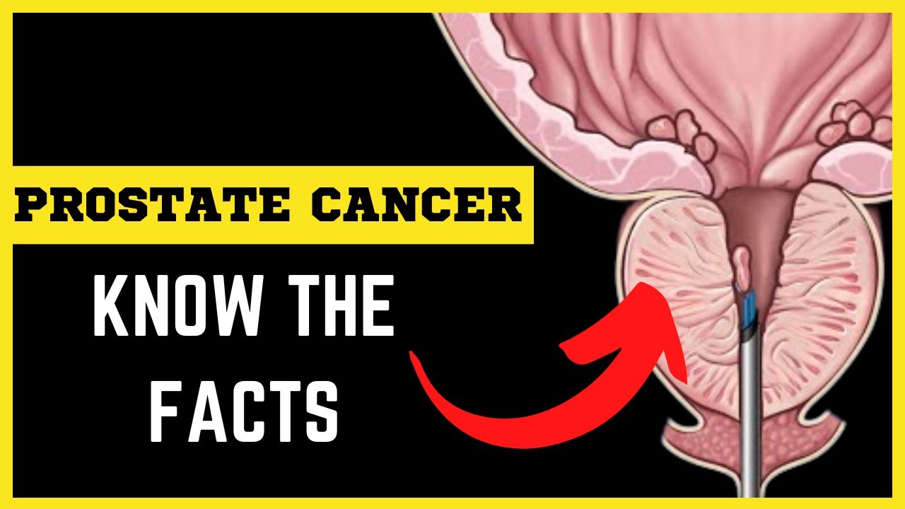 Learn the signs of prostate cancer and protect yourself! - YouTube