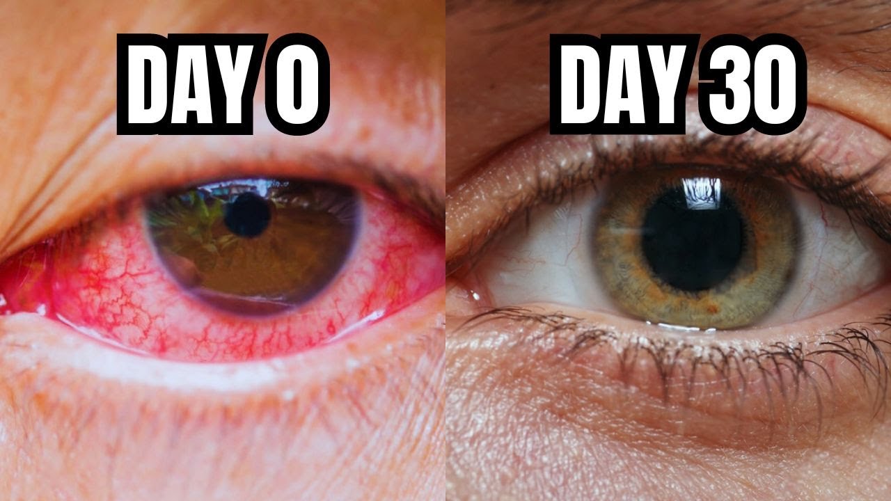 NoFap Benefits Timeline: All Nofap Benefits for 30 Days (Complete Guide ...