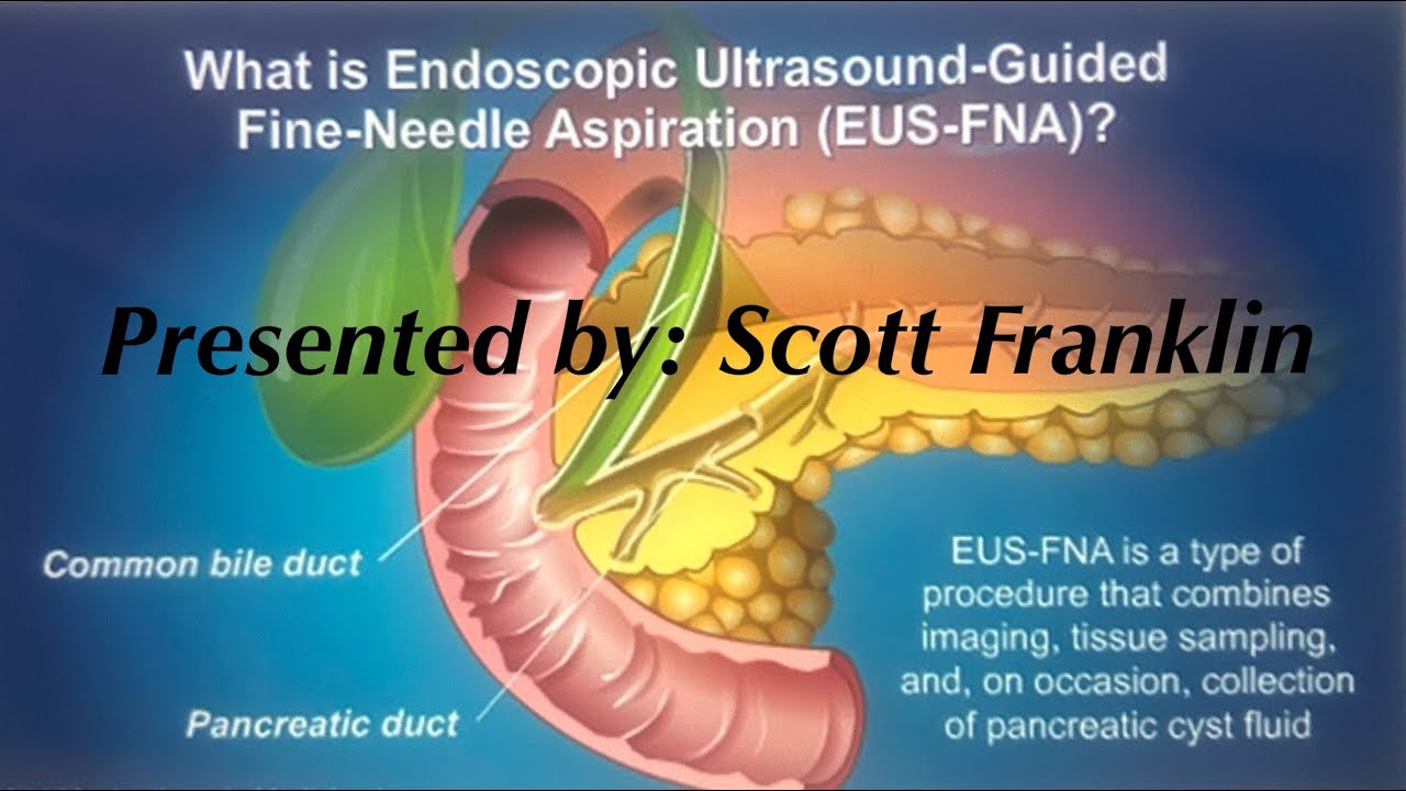 Endoscopic Ultrasound Fine Needle Aspiration - YouTube