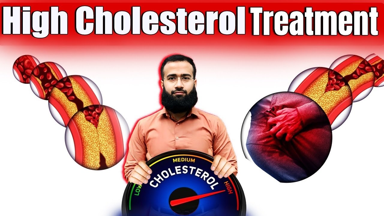 High Cholesterol Treatment | Natural way to lower cholesterol levels ...