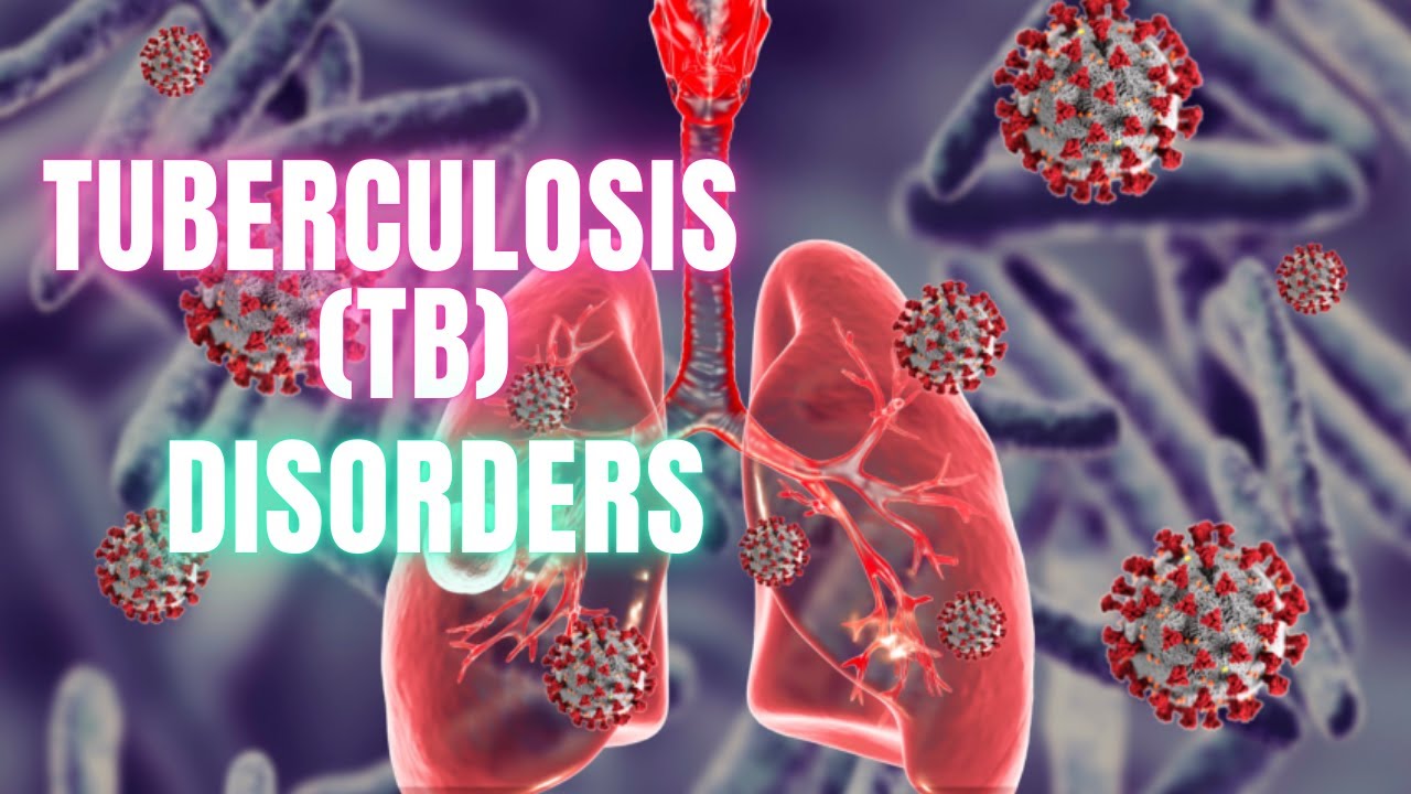 Stop Tuberculosis in its Tracks: Take Action Today | Dr Academy - YouTube