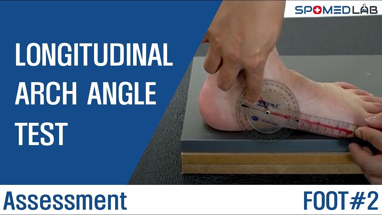 Longitudinal Arch Angle Test I 내측종아치 각도 평가 I foot#2 - YouTube