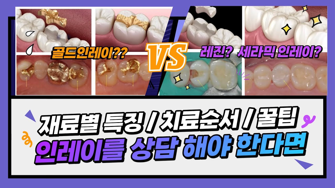 인레이(Inlay)치료 재료별 특징 / 치료방법 / 꿀팁 - YouTube