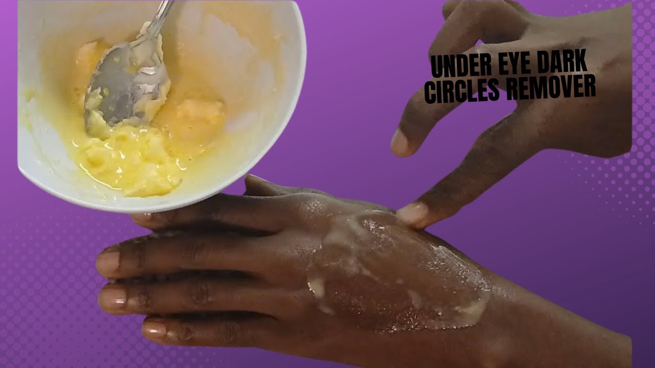 Under eye dark circles remover | DIY dark cycle remover - YouTube