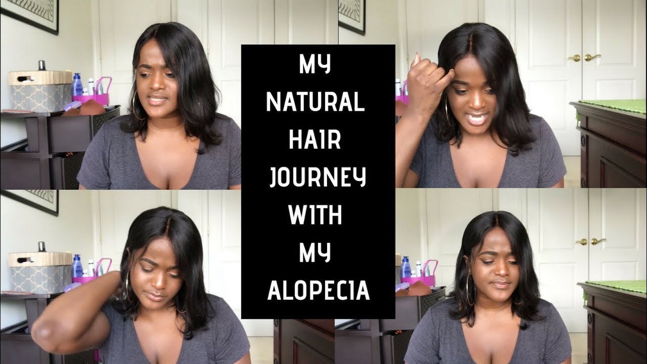 MY NATURAL HAIR JOURNEY WITH MY ALOPECIA - YouTube