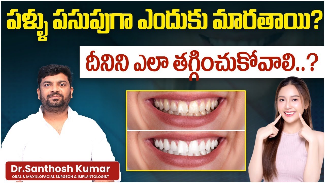 Why Do Teeth Turn Yellow and How to Reduce It | Causes and Solutions ...