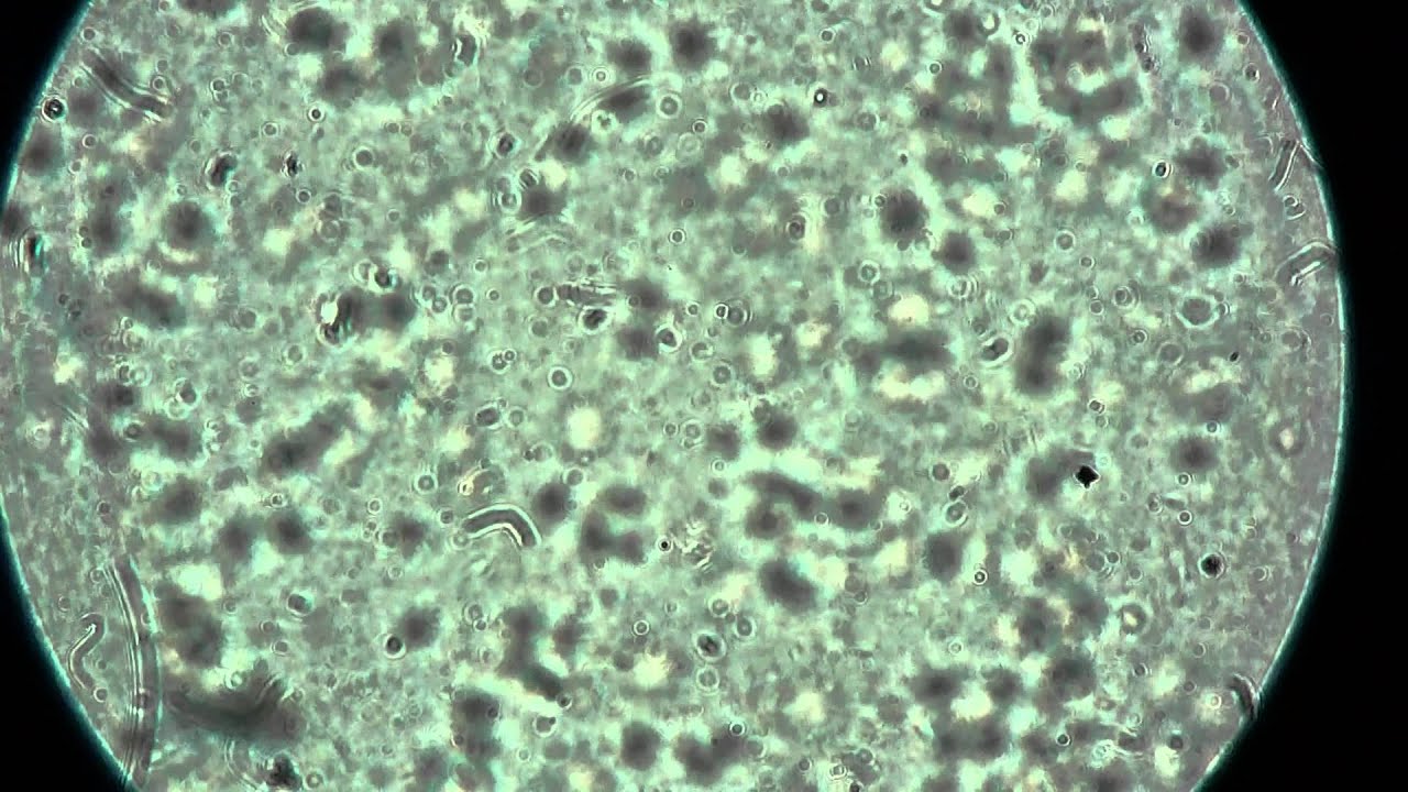 Unique Smallest Creatures Under Microscope X200: Infusoria in Water ...