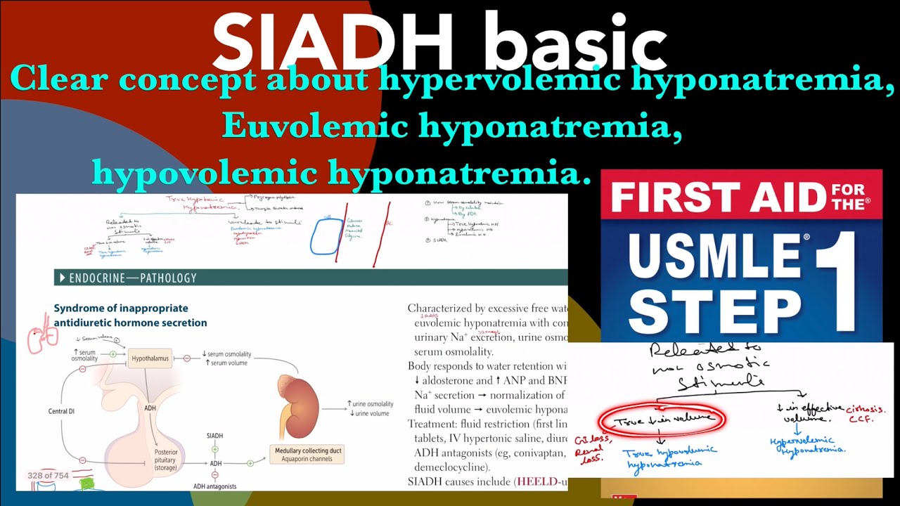 SIADH basic | Types & mechanisms of hyponatremia in Hindi/Urdu by first ...
