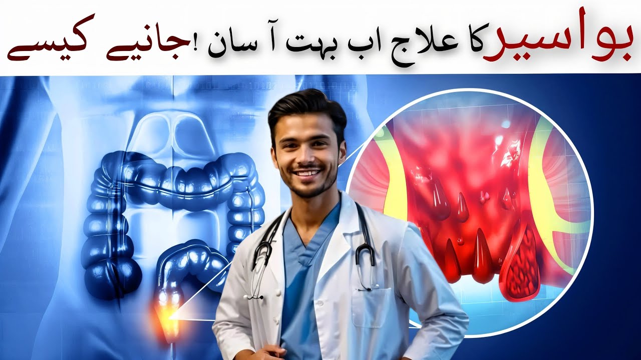 Say Goodbye to Hemorrhoids! Rubber Band Ligation Full Guide (Quick ...
