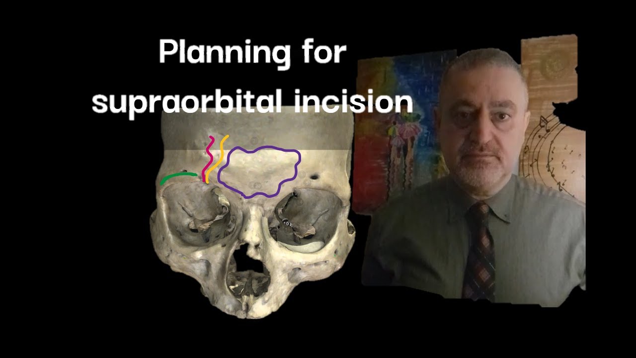Supraorbital notch - YouTube