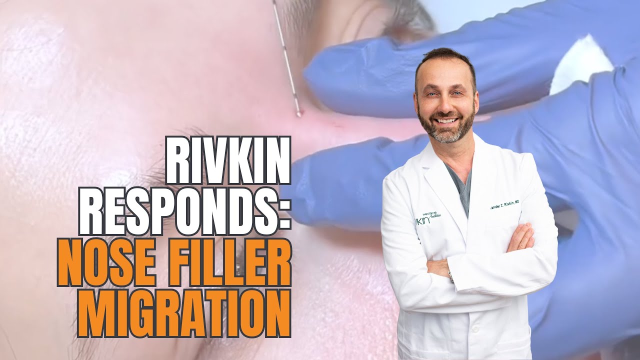 The truth about nose filler migration #nosefiller # ...