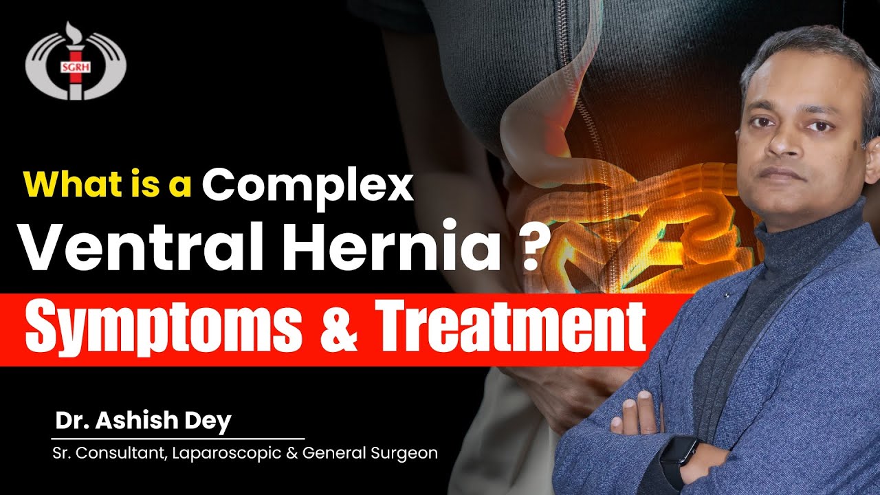 What is a Complex Ventral Hernia? Symptoms and Best Treatment Options ...