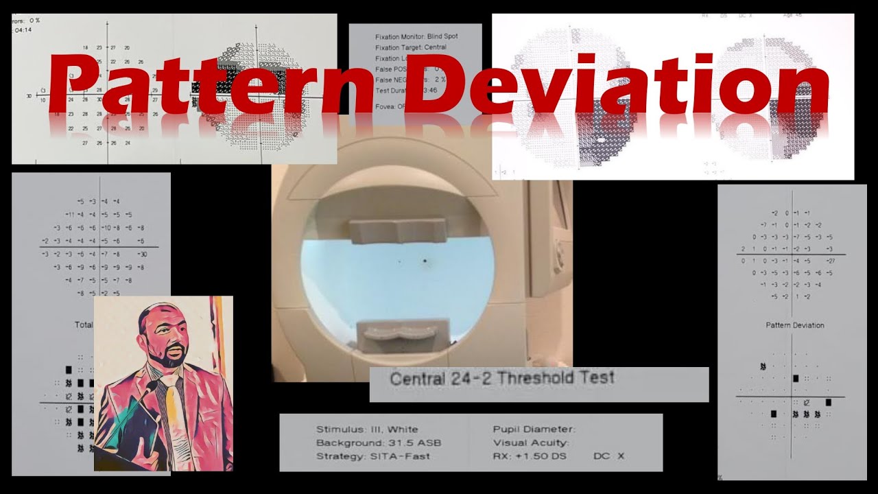 Pattern deviation: what it means - YouTube