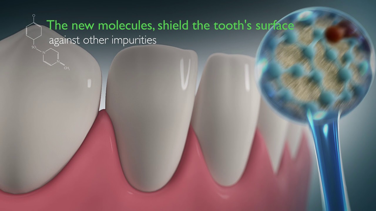 ToothWave and DentalRF technology - How it works - YouTube