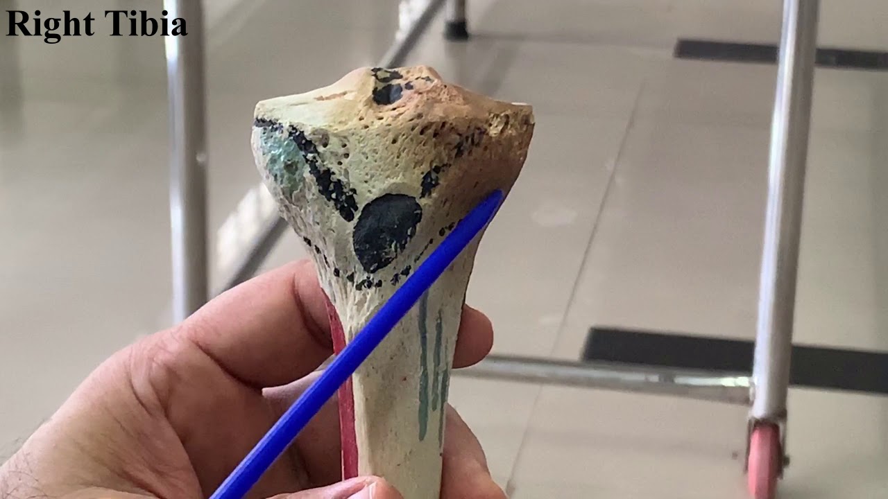 Osteology of Tibia - YouTube