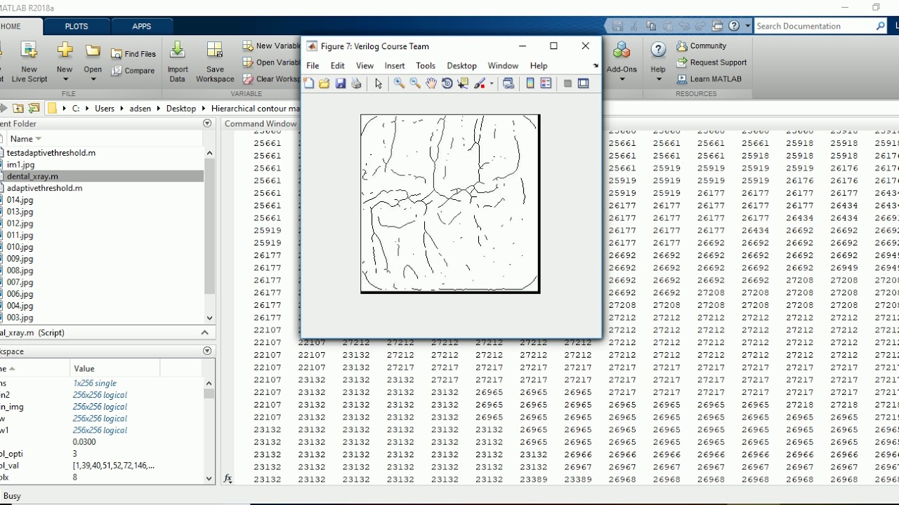 HIERARCHICAL CHAMFER DISTANCE IN DENTAL X-RAY RADIOGRAPHS USING MATLAB ...