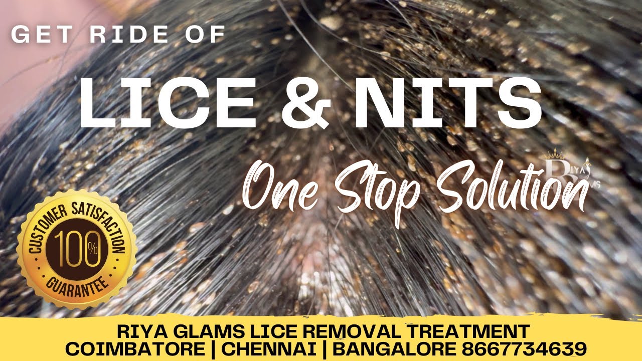 How to remove Lice from Hair/how to remove Lice permanently/how to ...