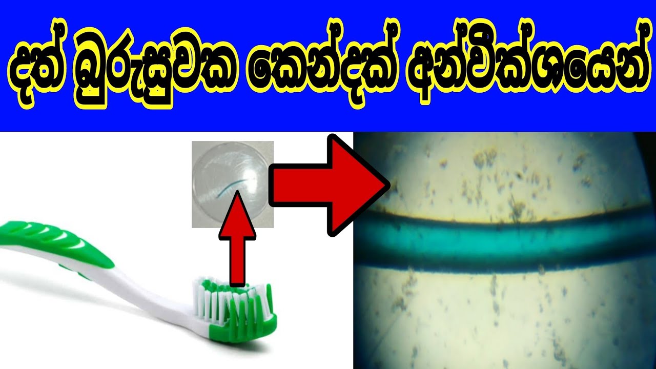 දත් බුරුසුවක කෙන්දක් අන්වීක්ශයෙන් | A toothbrush bristle under a ...