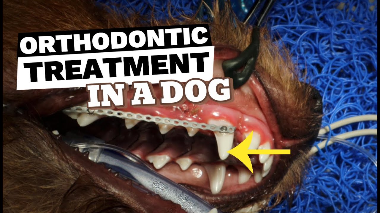 How to Correct a Linguoverted Mandibular Canine Using Orthodontic Power ...