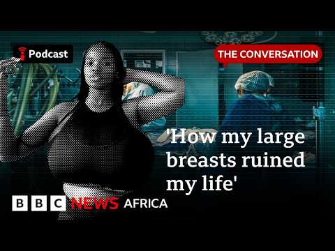 Gigantomastia: living with oversized breasts | The Conversation | Focus on Africa