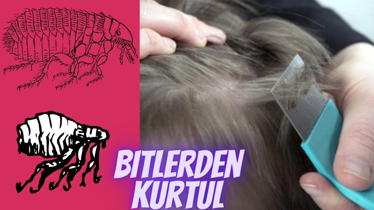 Saç Sirkesi- BİT TEMİZLEME/ Bitlenmeye Karşı Bit Savar💯 Doğal Yöntemle ...
