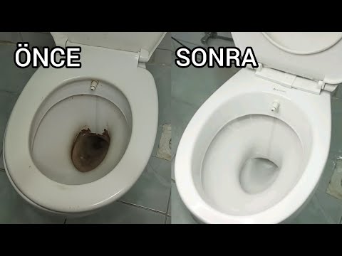 Sadece 5 Dakikada Sararmış Tuvalet Temizleme Yöntemi | Klozet Temizliği