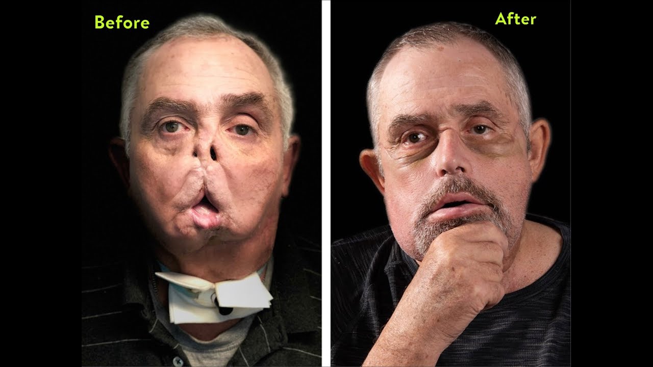 The most dangerous surgery in the entire world!!! - YouTube