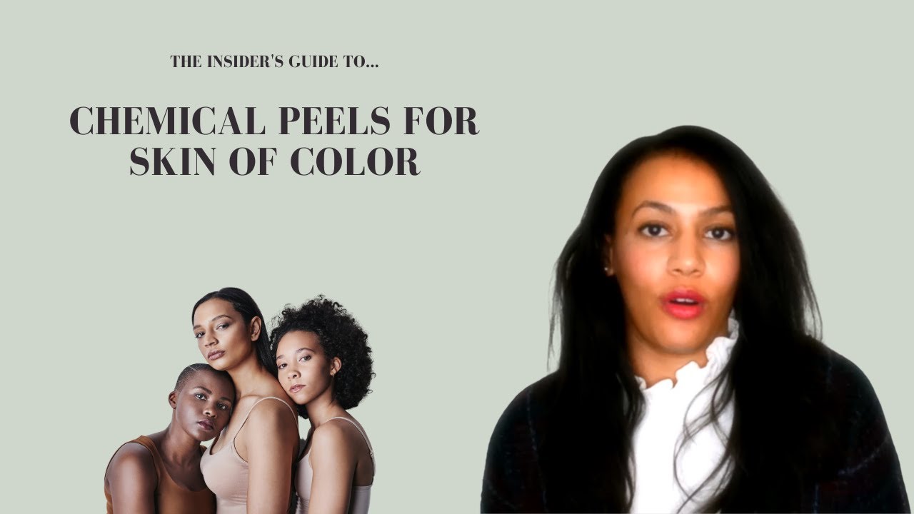 Chemical Peels for Skin of Color - The best chemical peels for black ...