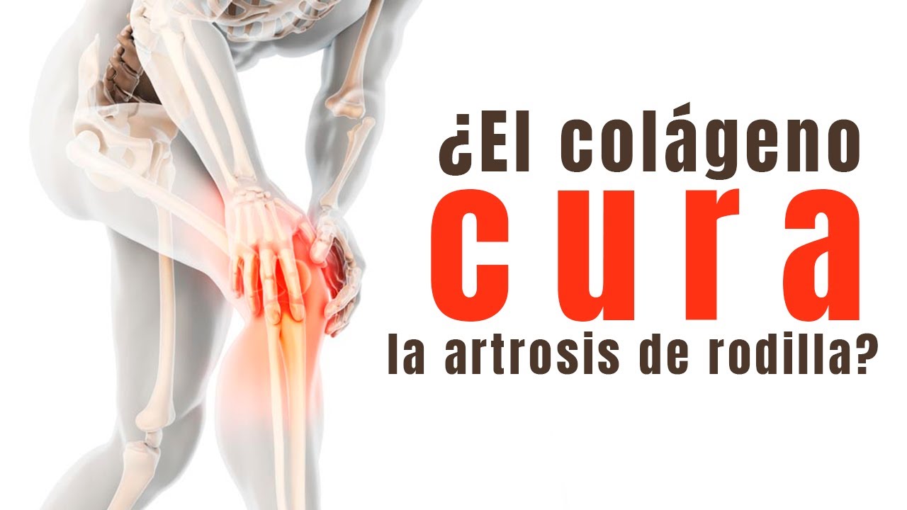 ¿El colágeno (fibroquel) cura la artrosis de rodilla? - YouTube