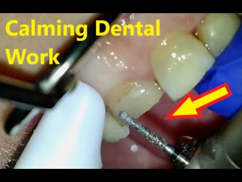 Cutting teeth with calming piano - YouTube