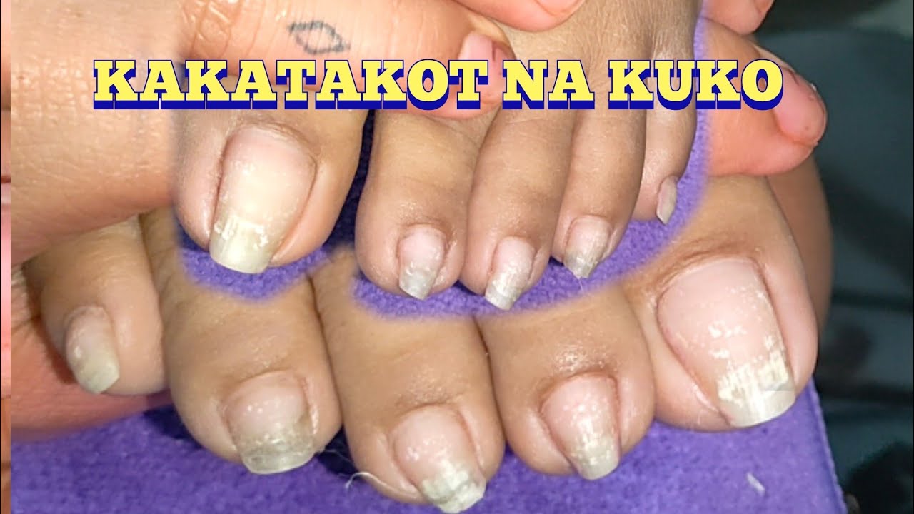 HOW TO REPAIR NARROW NAIL WITHOUT PAIN - YouTube