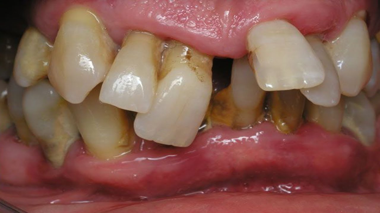 HOW TO GET RID OF GROSS YELLOW TEETH // TMI Tuesday - YouTube