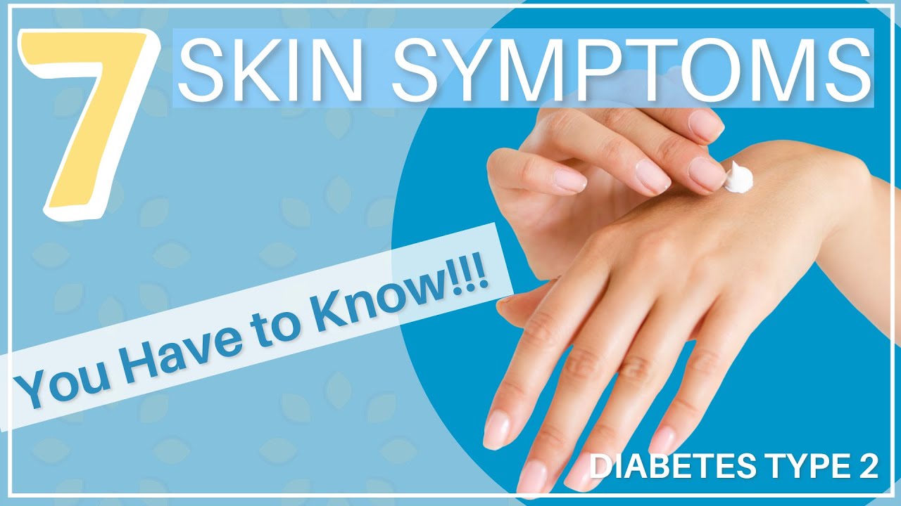 7⃣ Type 2 Diabetes Skin Symptoms that you have to know 🤔 - YouTube