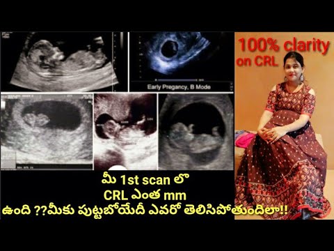 How to know the gender of the baby with CRL in mm||Baby boy symptoms ...