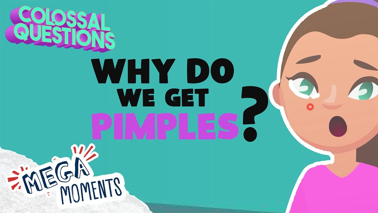 Why do we get PIMPLES!? 😱 | Colossal Questions 🧠 | Mega Moments - YouTube