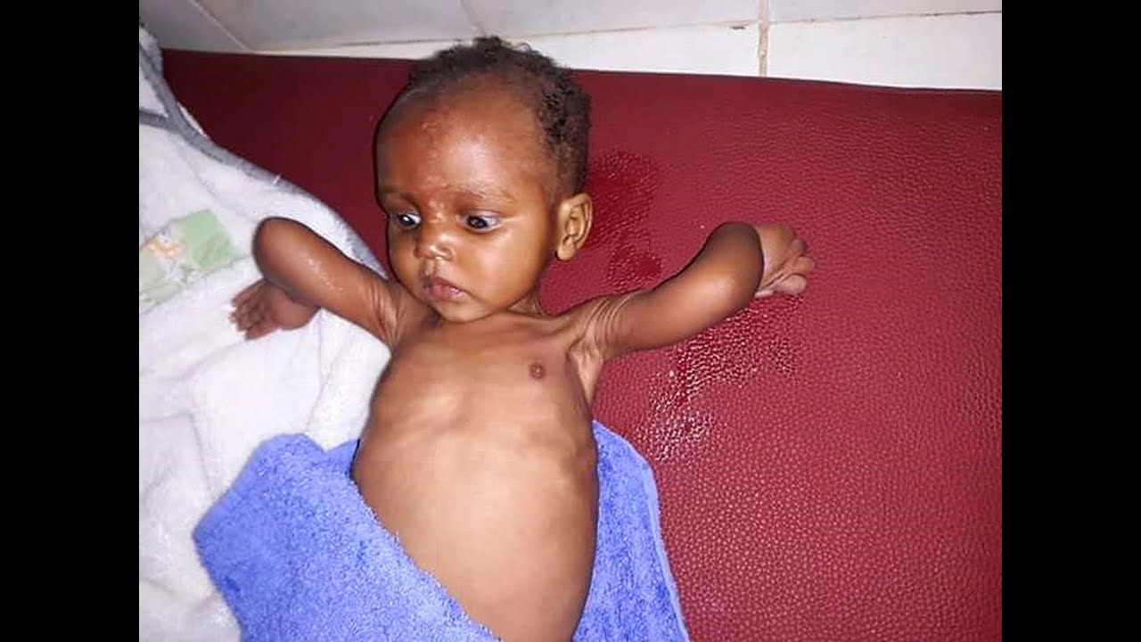 Baby Deborah at Cradle of Love Baby Home - YouTube