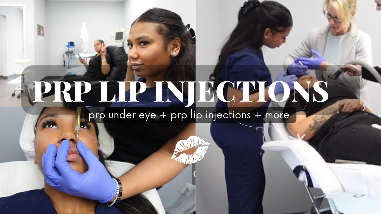 PRP LIP INJECTIONS & PRP UNDER EYE CIRCLES - YouTube