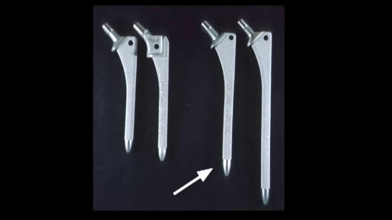 Trochanteric Osteotomy for Revision Total Hip … - YouTube