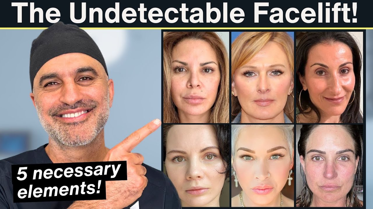 Plastic Surgeon reveals the 5 Necessary Ingredients to a Facelift that ...