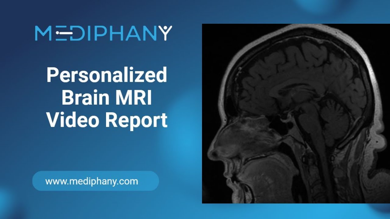 Brain MRI Video Report - YouTube